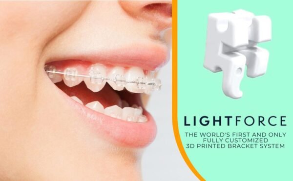 3D-Printed Custom Braces by Your Philadelphia Orthodontist | Art of Smile