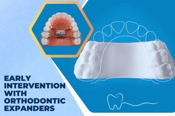 Orthodontic Expanders: Benefits & Early Treatment Explained
